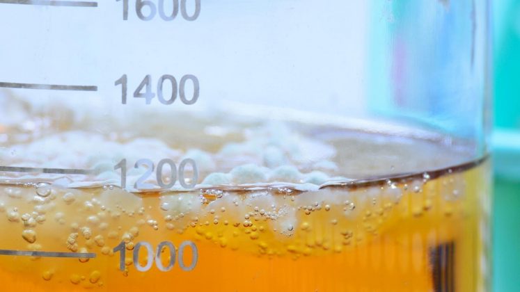 Beer Headache: Causes, Cures and Everything You Need To Know