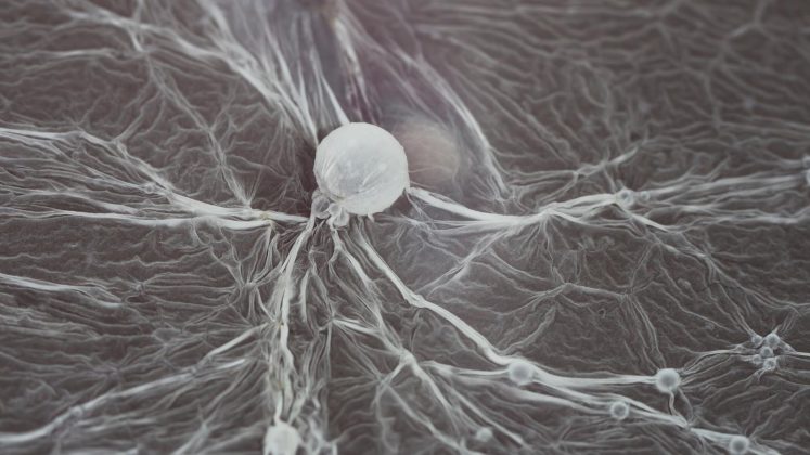 Infected Beer: Identifying and Preventing Homebrew Infection